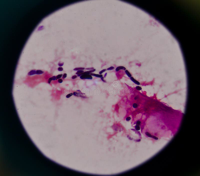 Budding Yeast Cell in Gram Stain Method. Stock Image - Image of microbe ...