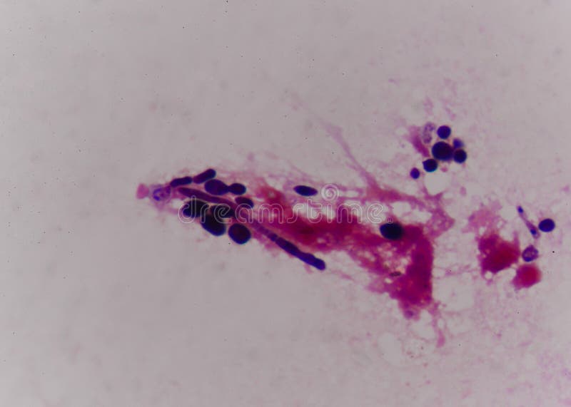 Budding Yeast Cell in Gram Stain Method. Stock Photo - Image of ...