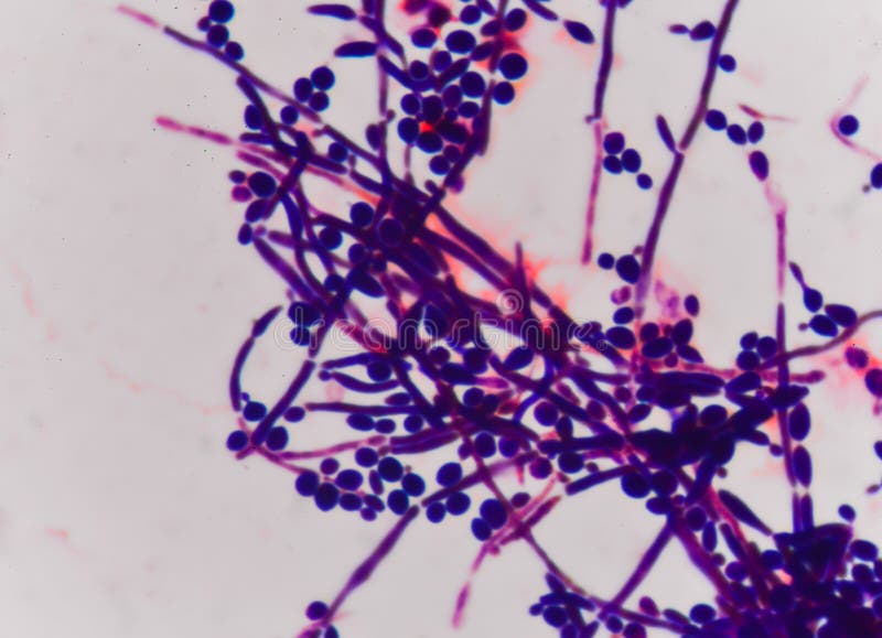 Budding Yeast Cell Structure Stock Photo - Image of organism, human ...