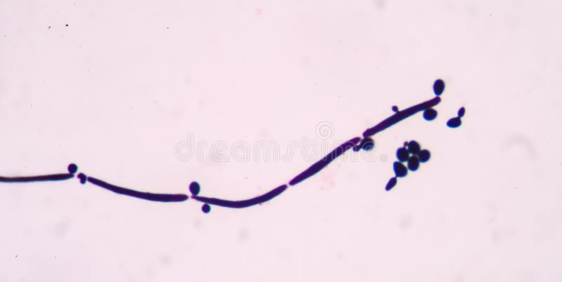 Budding Yeast Cells With Pseudohyphae Stock Photo - Image: 58379951