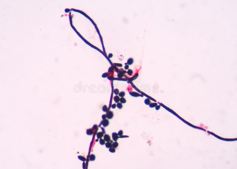 Budding Yeast Cells with Pseudohyphae Stock Image - Image of hyphal ...