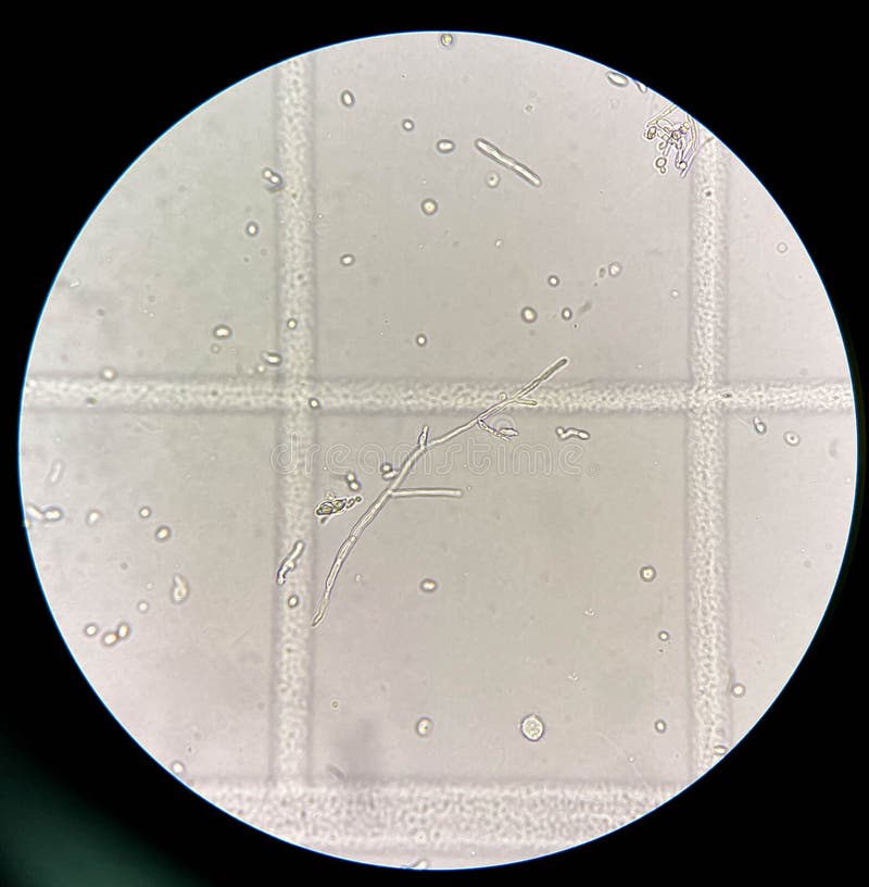 Yeast Cells Under Microscope 40x