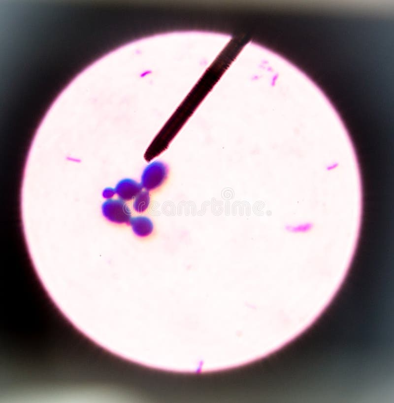 Budding yeast cells. stock photo. Image of candida, infectious - 56807124