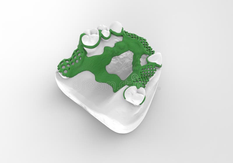 Bugel Vax Stock Illustrations – 1 Bugel Vax Stock Illustrations ...