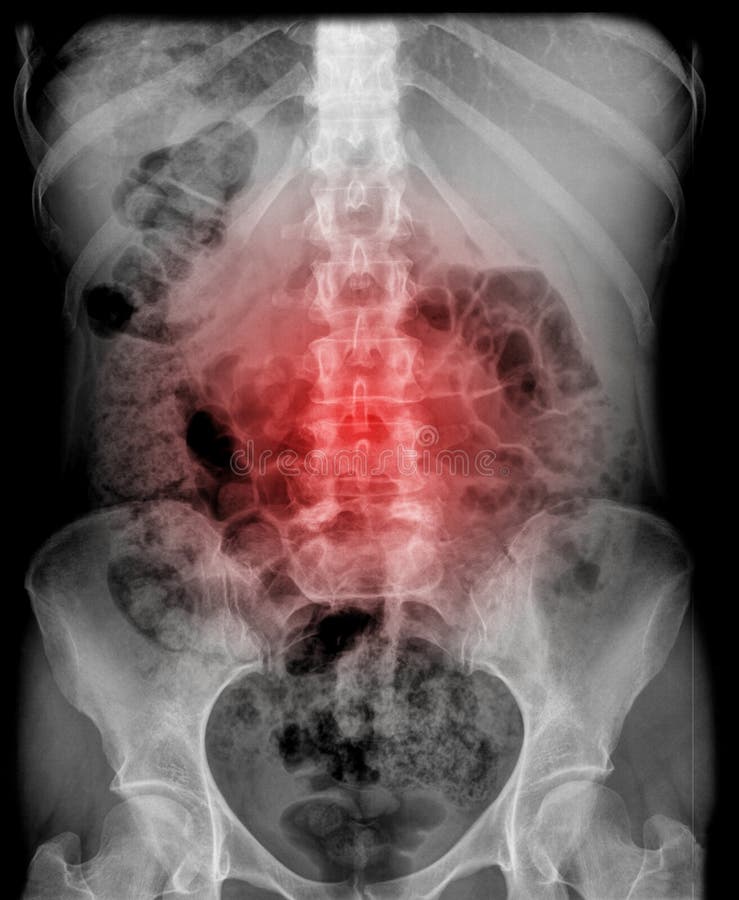 Buikpijn, maagpijn stock foto. Image of pijnlijk, buik - 13770514