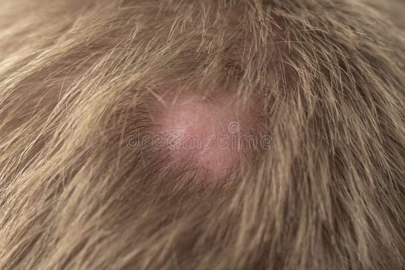 Bump on the head. stock photo. Image of injury, crown - 248359530