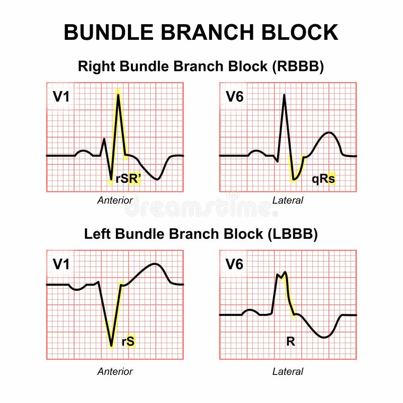 Amplitude Intervals Stock Illustrations – 4 Amplitude Intervals Stock ...