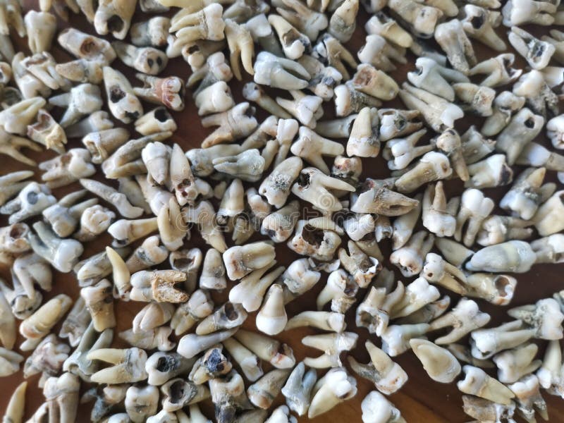 The Bundle of Unwanted Extracted Decay Human Teeth. Stock Image - Image ...