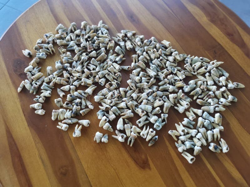 The Bundle of Unwanted Extracted Decay Human Teeth. Stock Image - Image ...