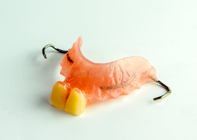 Plaster Denture Model with Wire for Make Denture Stock Photo - Image of ...