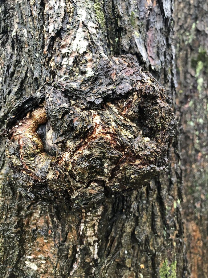 Burl Growth on a Tree Trunk with Cracked Bark, Rough Texture Stock ...