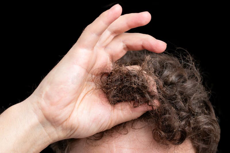 Burnt hair on his head stock photo. Image of clean, brown - 210273430