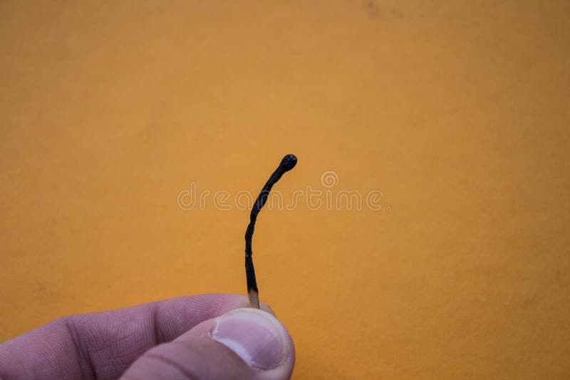 Burnt Fingers, Finger Fire Caused by Negligence, Skin Burn on Finger ...