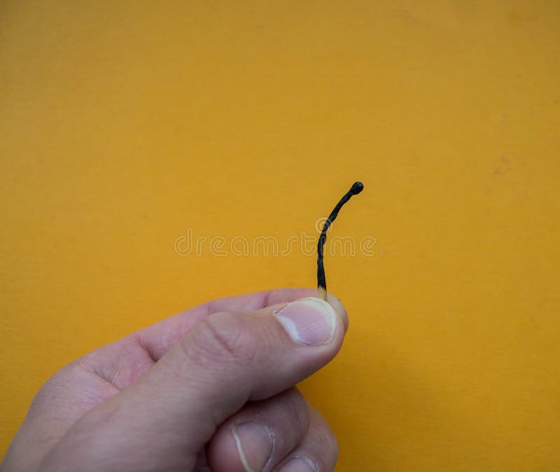 Burnt Fingers, Finger Fire Caused by Negligence, Skin Burn on Finger ...