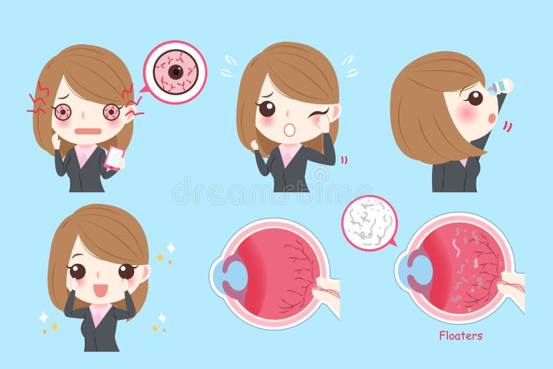 Cornea Sclera Eye Stock Illustrations – 306 Cornea Sclera Eye Stock ...