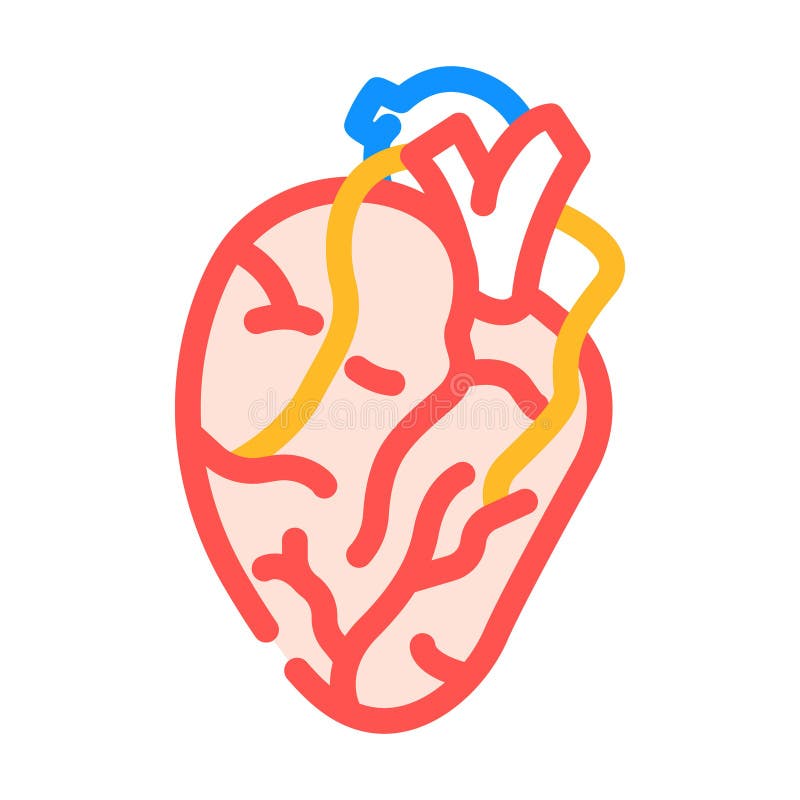 Bypass Surgery Surgery Color Icon Vector Illustration Stock ...