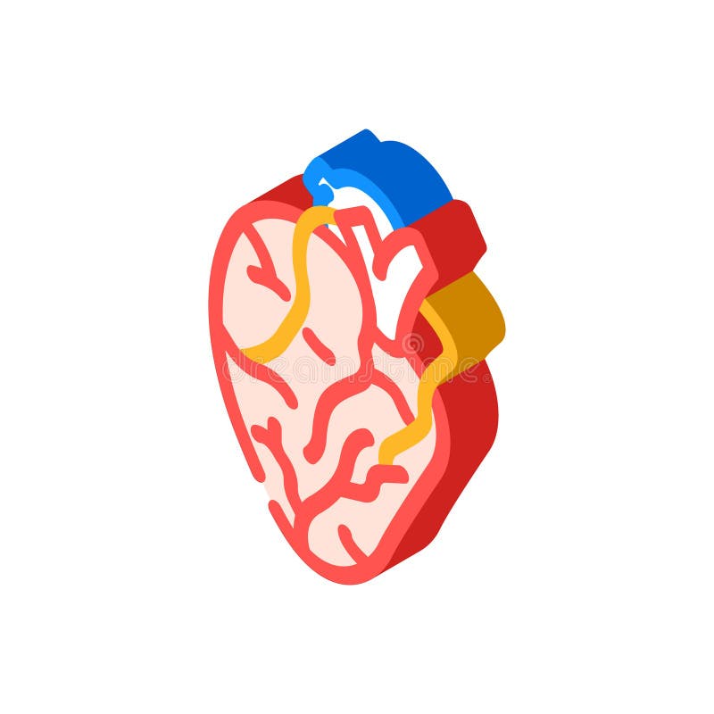 Bypass Surgery Surgery Isometric Icon Vector Illustration Stock ...