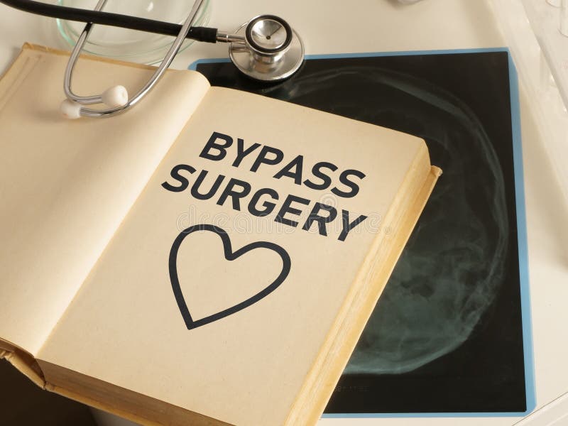 Bypass Surgery Procedure is Shown Using the Text Stock Photo - Image of ...