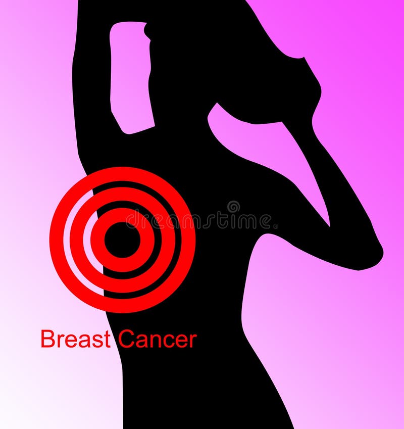 Diagnóstico Médico De La Medicina De La Quimioterapia Del Tratamiento ...