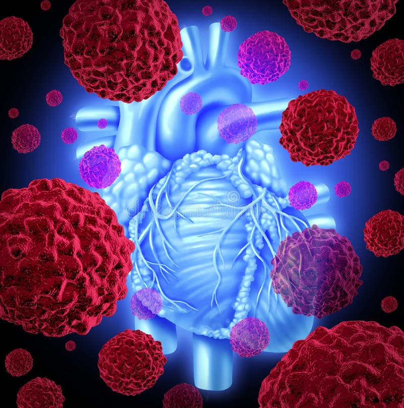 Cáncer humano del corazón stock de ilustración. Ilustración de ...