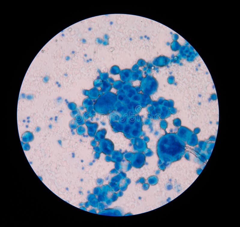 Células de Mesothelial stock de ilustración. Ilustración de humano ...