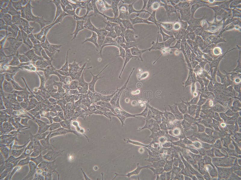 Células En Un Microscopio 2 Foto de archivo - Imagen de fibroblastos ...