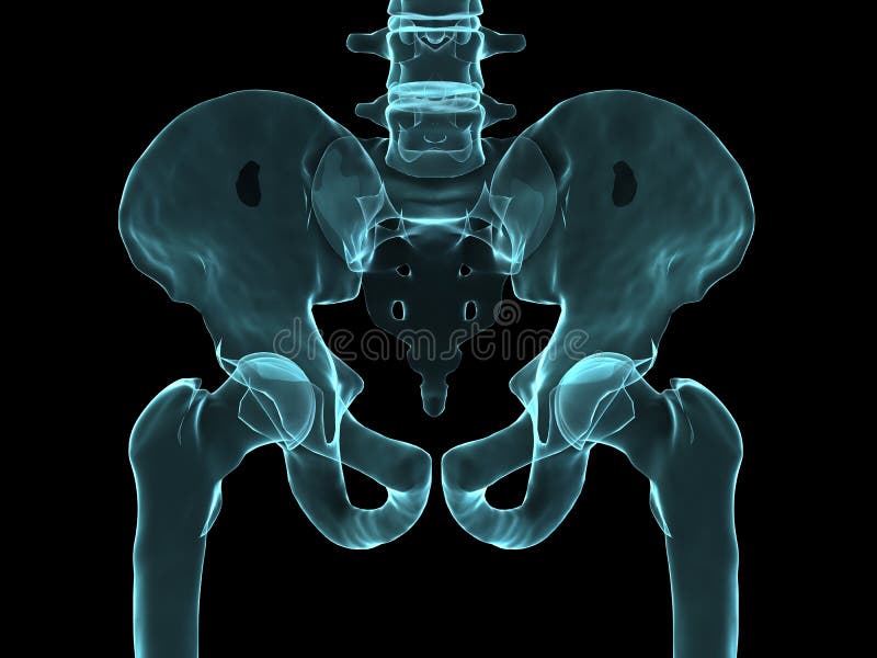 Cadera de la radiografía stock de ilustración. Ilustración de huesos ...
