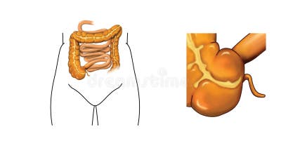 Caecum and appendix stock illustration. Illustration of position - 25232922
