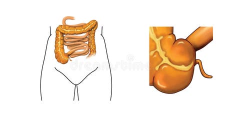 Caecum and appendix stock illustration. Illustration of position - 25232922