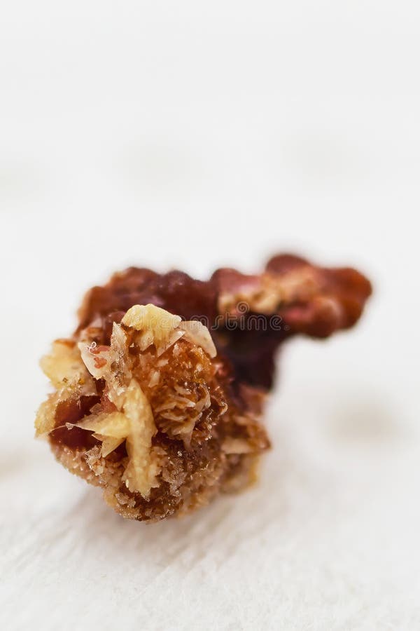 Calcium Oxalate Stone from the Kidney Closeup. Urolithiasis Stock Photo ...