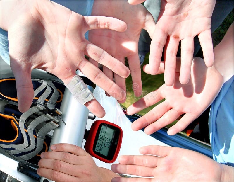 Callosities on hands stock image. Image of competitor - 21545043