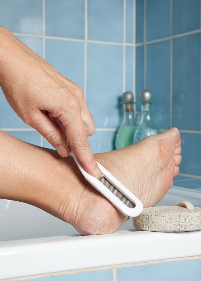 Callosity stock photo. Image of foot, dermatology, feet - 17281050