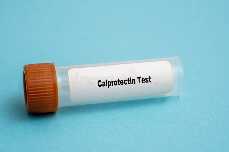 Calprotectin Test Calprotectin Test Calprotectin Test Stock Image ...