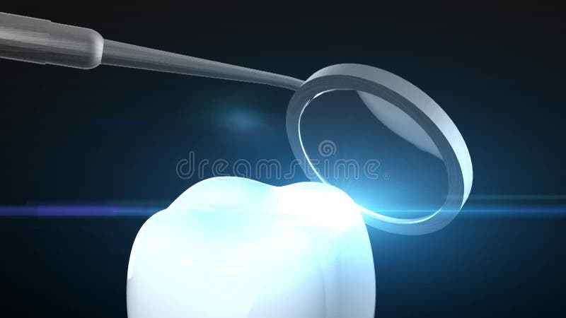Camera Angles of a Tooth with Dental Tool 3d Animation with White ...