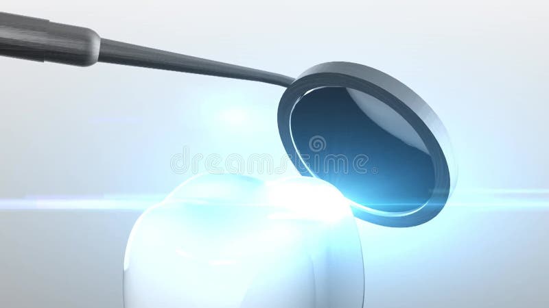 Camera Angles of a Tooth with Dental Tool 3d Animation with White ...