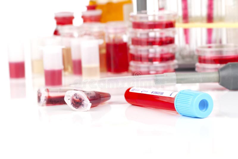 Campione Di Sangue In Una Provetta Vacutainer Immagine Stock - Immagine ...