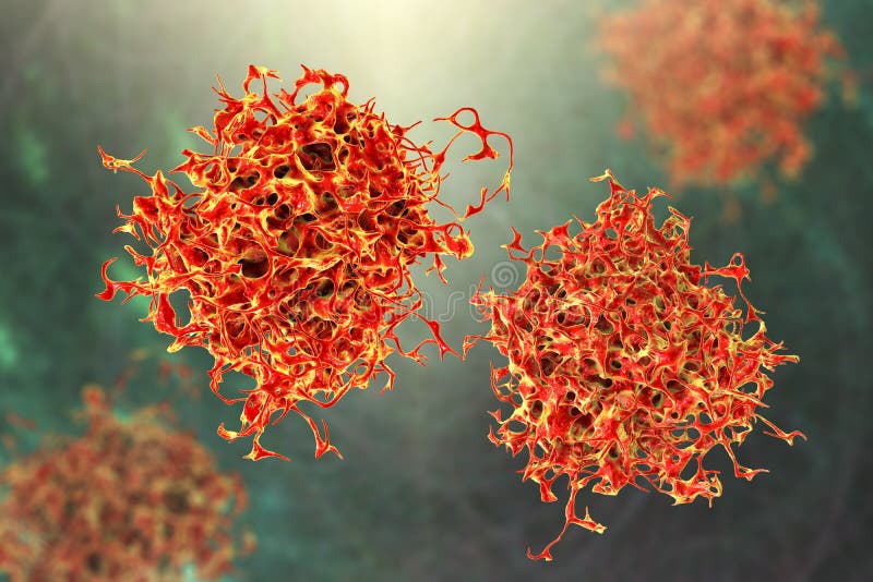 Cancer Cell, Malignant Tumor Cell Stock Illustration - Illustration of ...