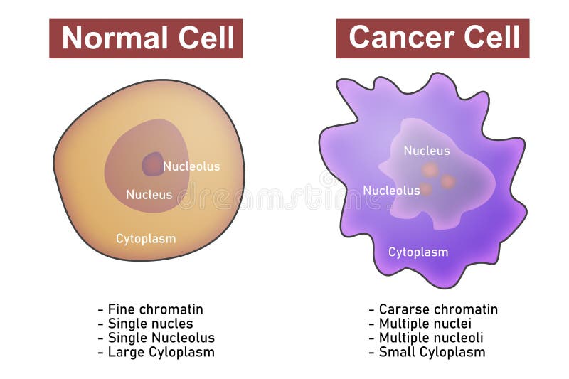 Cancer Cell and Normal Cell Comparison Stock Illustration ...