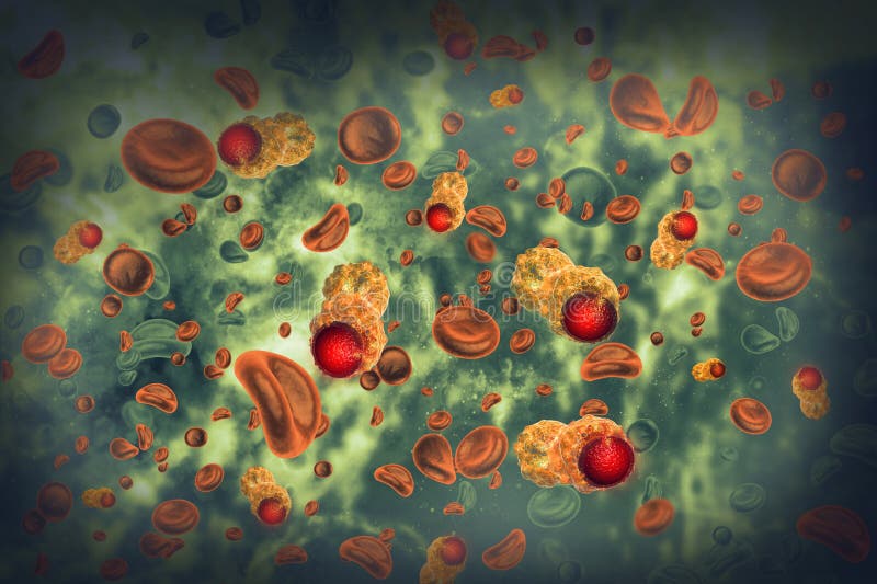 Cancer Cells Infected Blood Stock Illustration - Illustration of ...