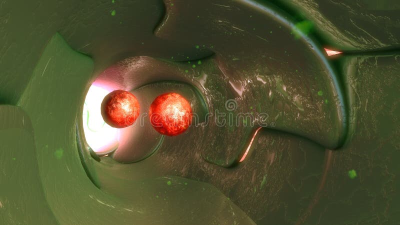 Cancer Cells in Lymp Vessels Stock Illustration - Illustration of ...