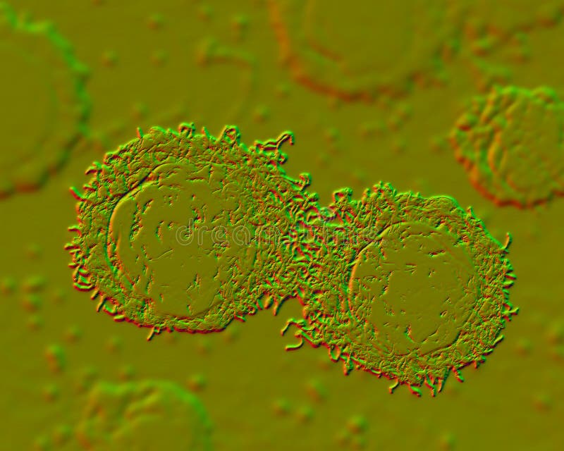 Cancer Cells, 3D Illustration Stock Illustration - Illustration of ...