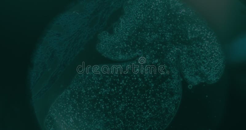 Cancer Cells Under Microscope at Laboratory Stock Video - Video of ...