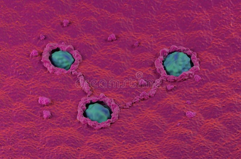 Cancerous Colon Surface Super Macro Colorectal Cancer Isometric View 3d Illustration Stock