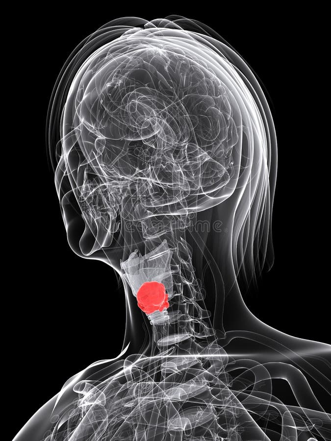 Cancro della laringe illustrazione di stock. Illustrazione di medico ...