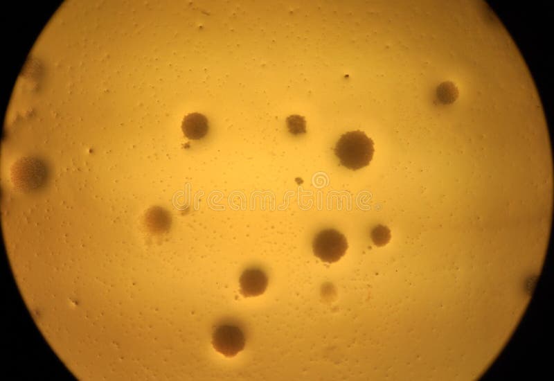 Microscope View of Candida Albicans Colonies Stock Photo - Image of ...