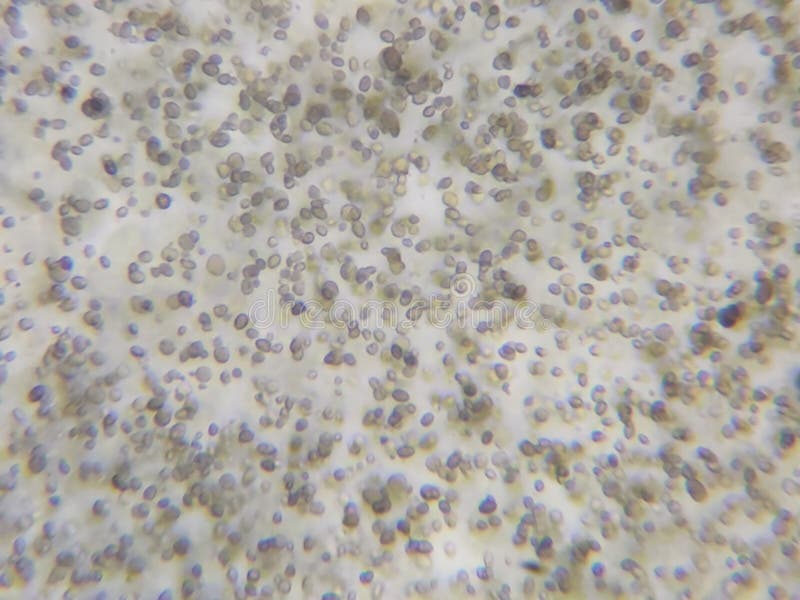 Candida Albicans Under the Microscope Stock Afbeelding - Image of groei ...