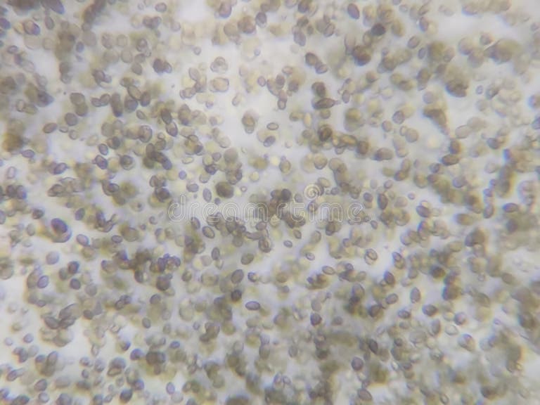 Candida Albicans Under the Microscope Stock Photo - Image of agar ...