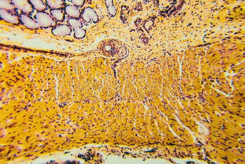 Cane Dell'esofago Di Sezione Trasversale Immagine Stock - Immagine di ...