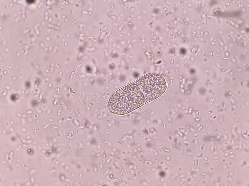 Capillaria Philippinensis Egg