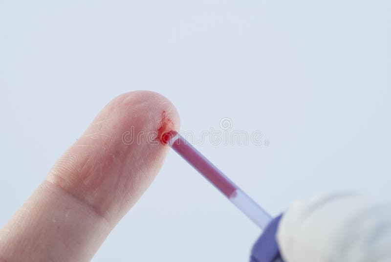 Capillary bloodtest stock photo. Image of capillary, close - 19023024